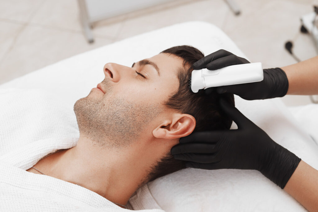 7 Tips for Using Derma Rollers and Micro-Needling for Hair Restoration